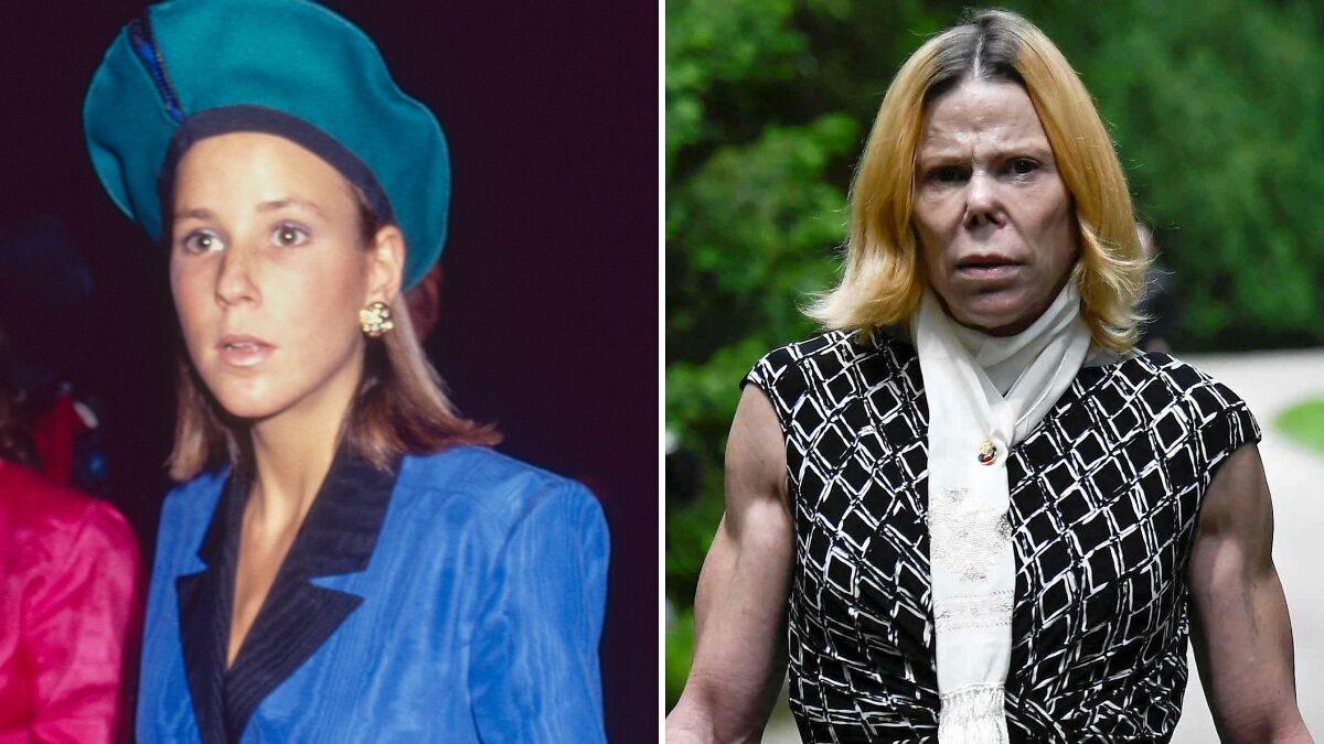 20 Celebrity Transformations That Left Us Speechless In 2024