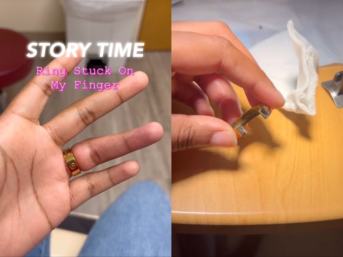 Woman visits three emergency rooms to get ring off finger - only to buy ...