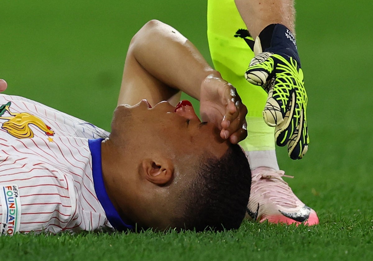 Kylian Mbappe injury latest: Custom mask being made but question marks ...