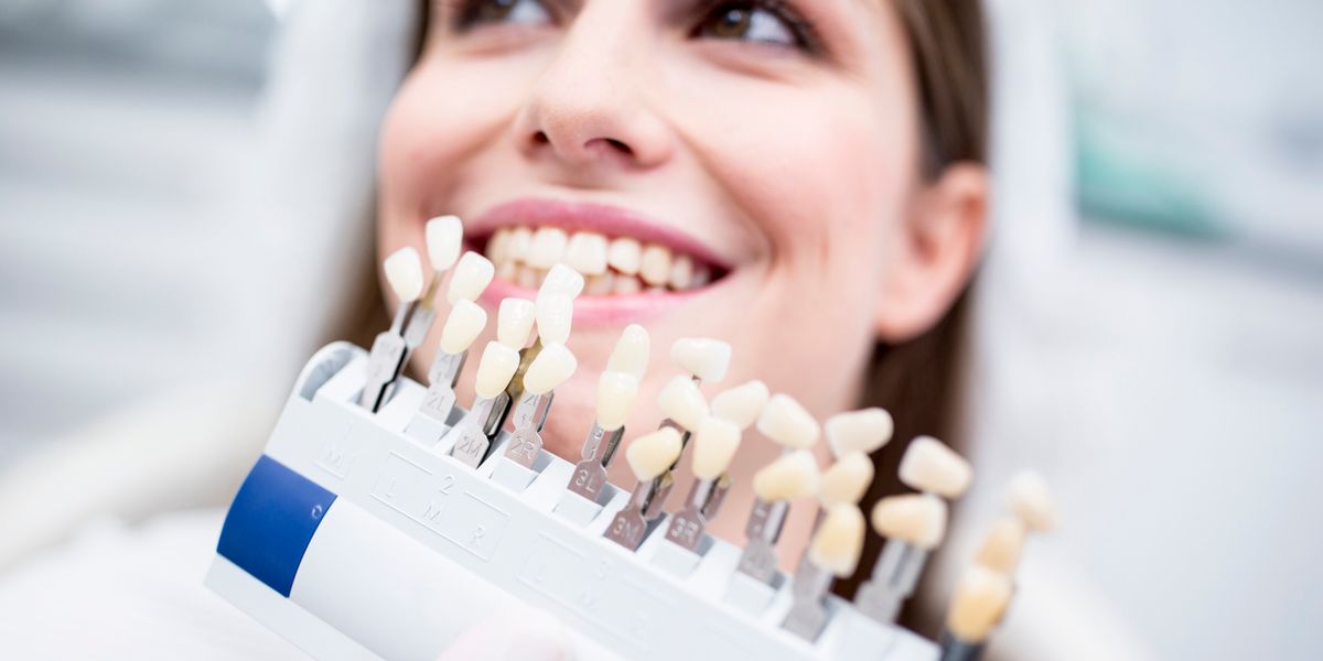 Viral 'Veneer Techs' Offer Beautiful Teeth For Less, But There's A Big ...