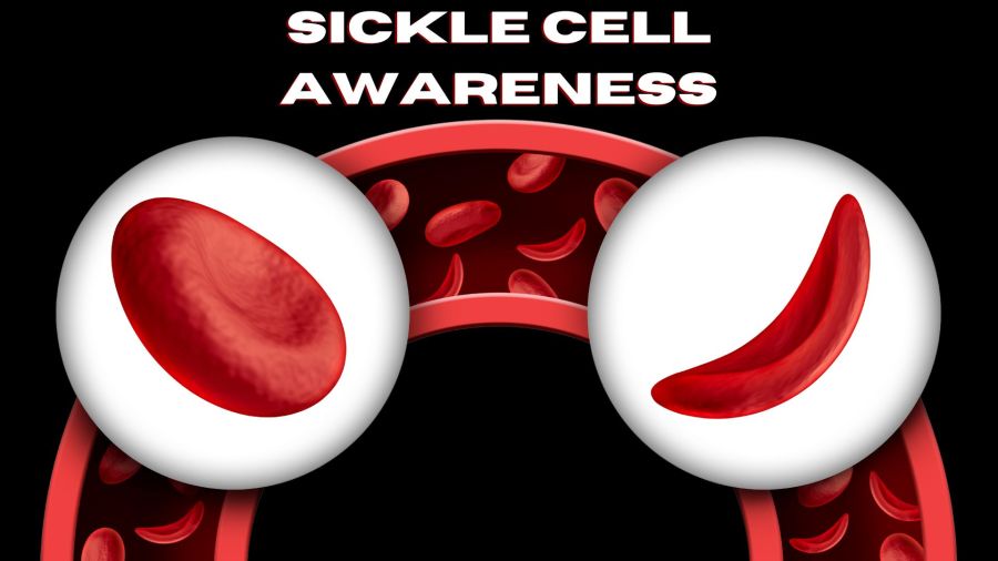 Acknowledging Sickle Cell Awareness Month and Those Who Persevere