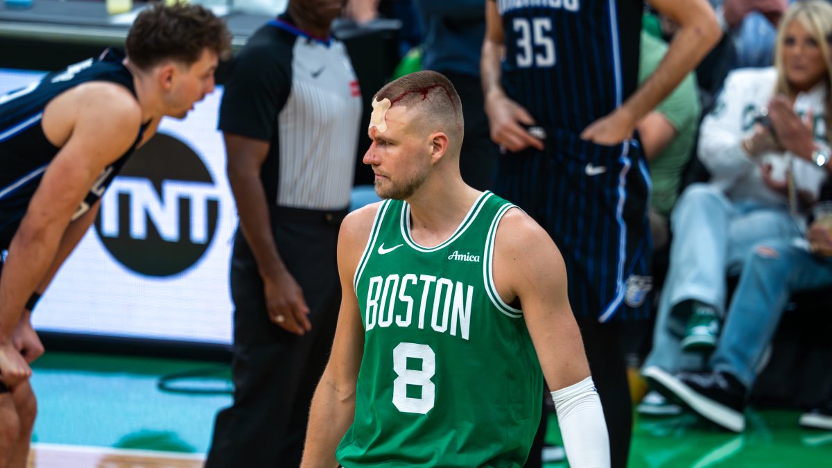 Kristaps Porzingis bloodied after taking elbow to the head - Yahoo Sports