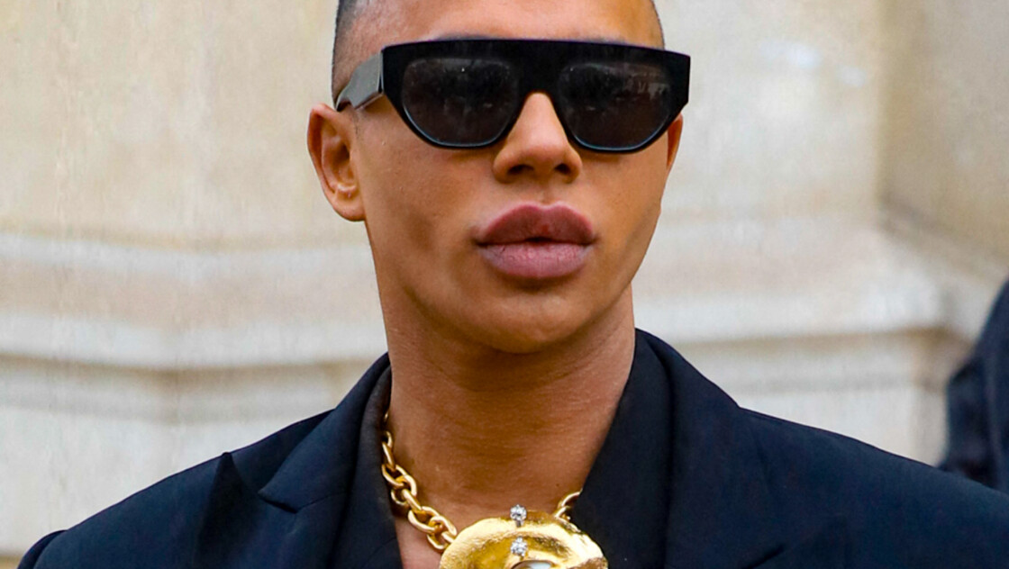 Olivier Rousteing, photo de son visage et de son corps brûlés : une explosion qui aurait pu lui ...