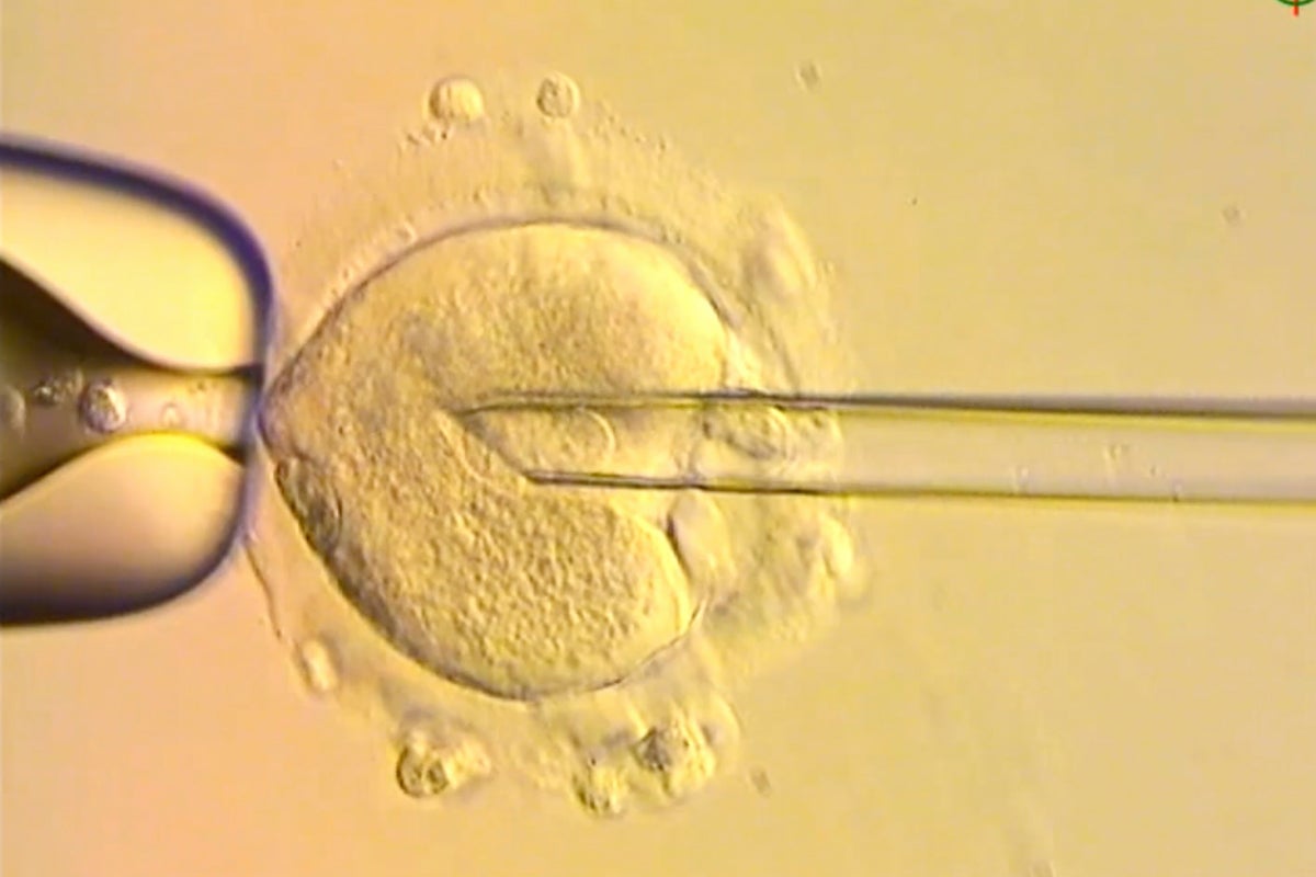 IVF technique using DNA from three people sees eight babies born free of hereditary disease ...