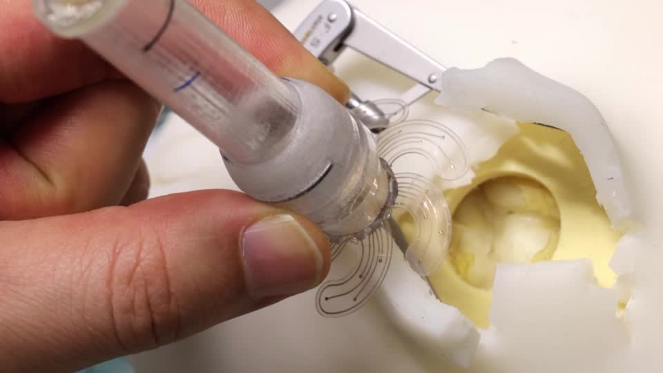 Swiss scientists develop soft brain implant